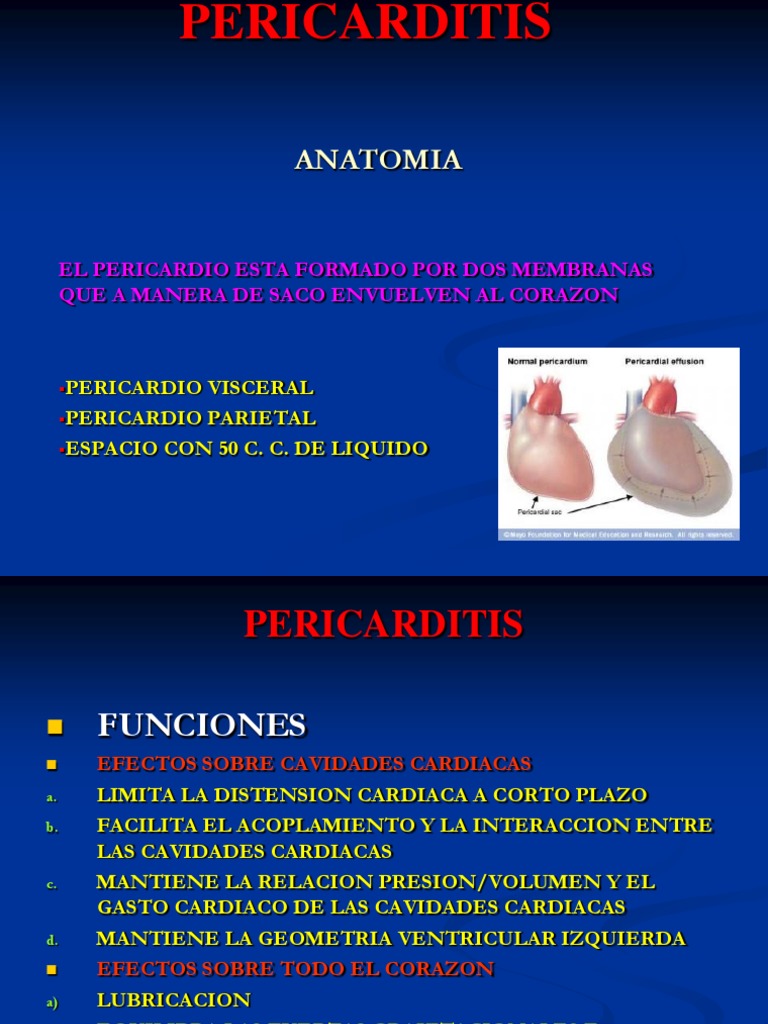 PERICARDITIS.ppt | Cardiología | Medicina Interna | Prueba gratuita de ...