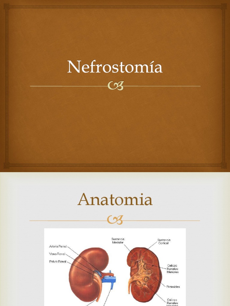 nefrostomia.pptx | Bile | Kidney