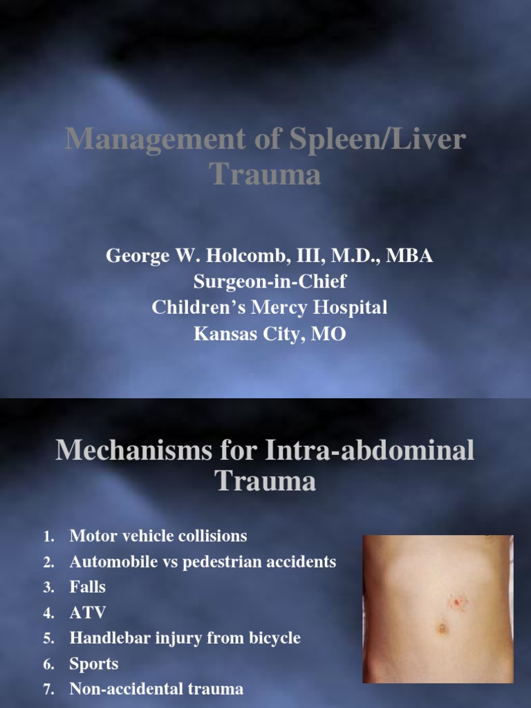 7 Liver - Spleen Trauma | PDF | Major Trauma | Spleen