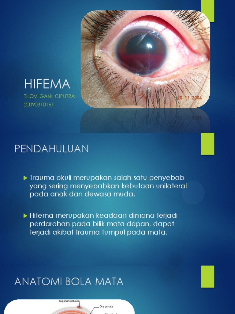 HIFEMA | PDF