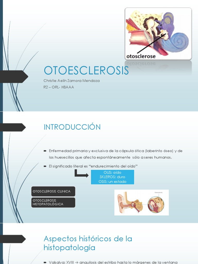 OTOESCLEROSIS | PDF | Sistema Auditorio | Especialidades Medicas