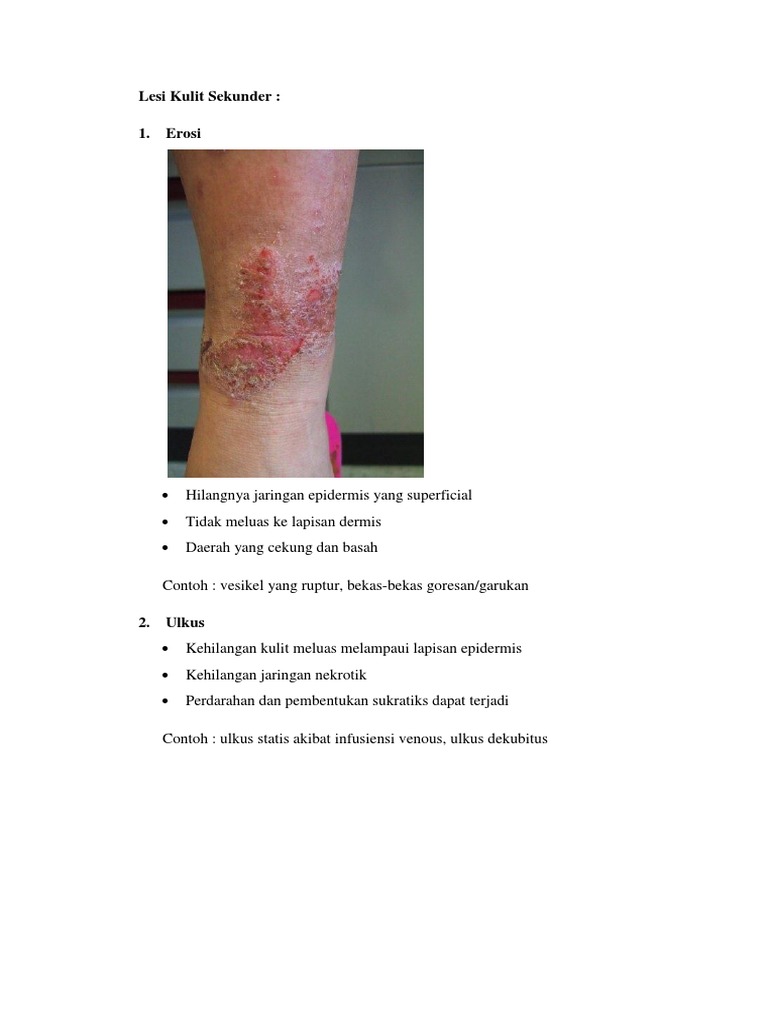Lesi Kulit Sekunder | PDF