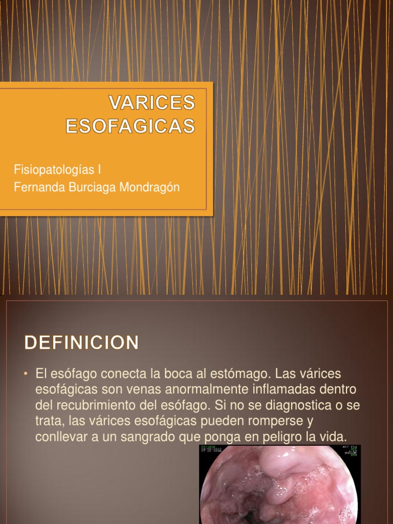 Várices esofágicas: causas y tratamiento | PDF | Enfermedades y ...