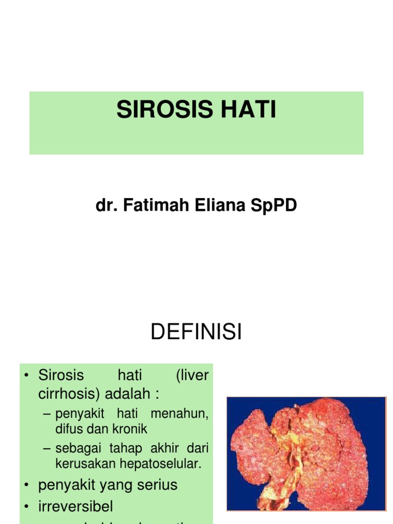 Sirosis Hati | PDF