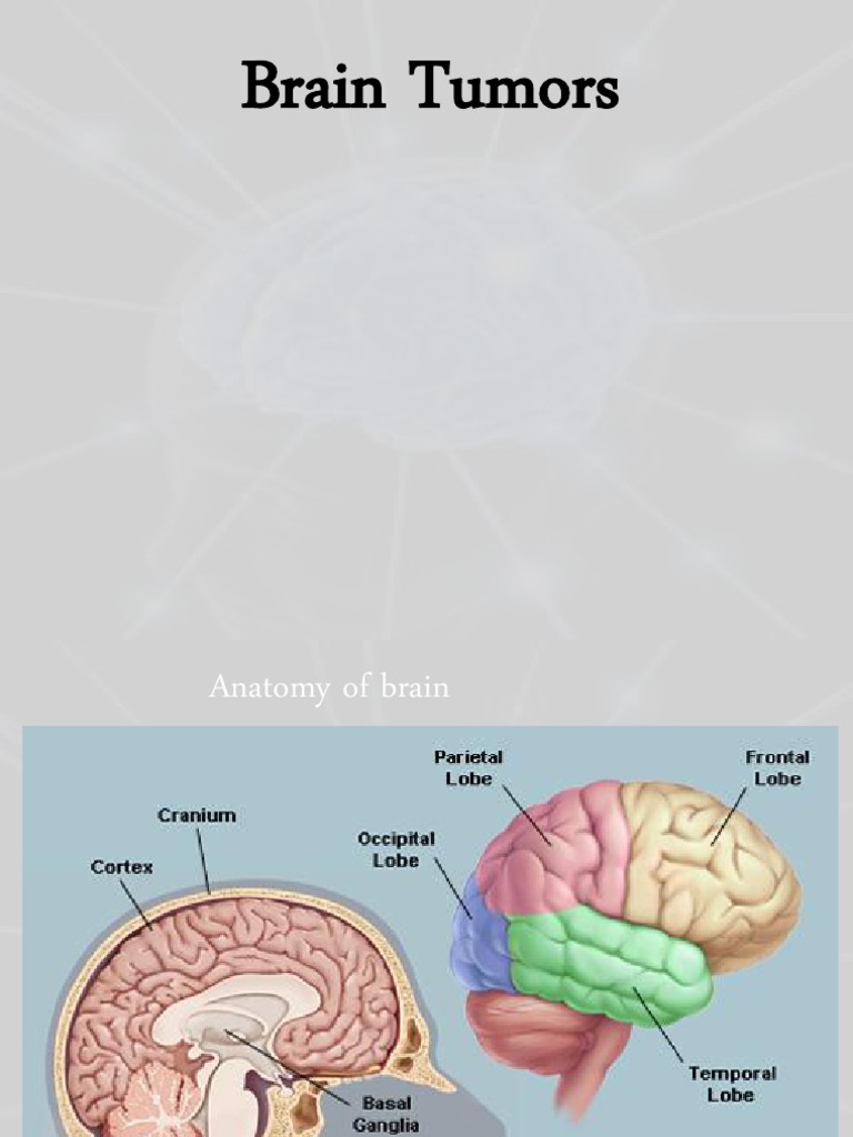 Brain Cancer | PDF | Brain Tumor | Glioma