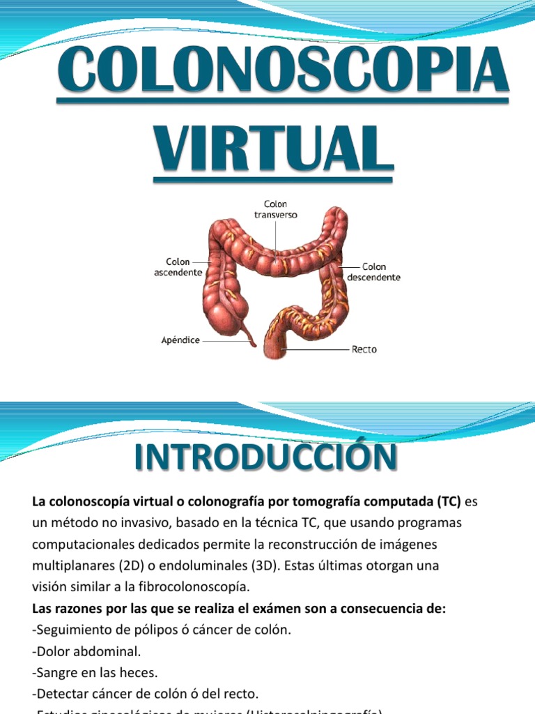 COLONOSCOPIA VIRTUAL (Toñi Zaragoza y Martina Cerezo) | PDF | Cáncer ...