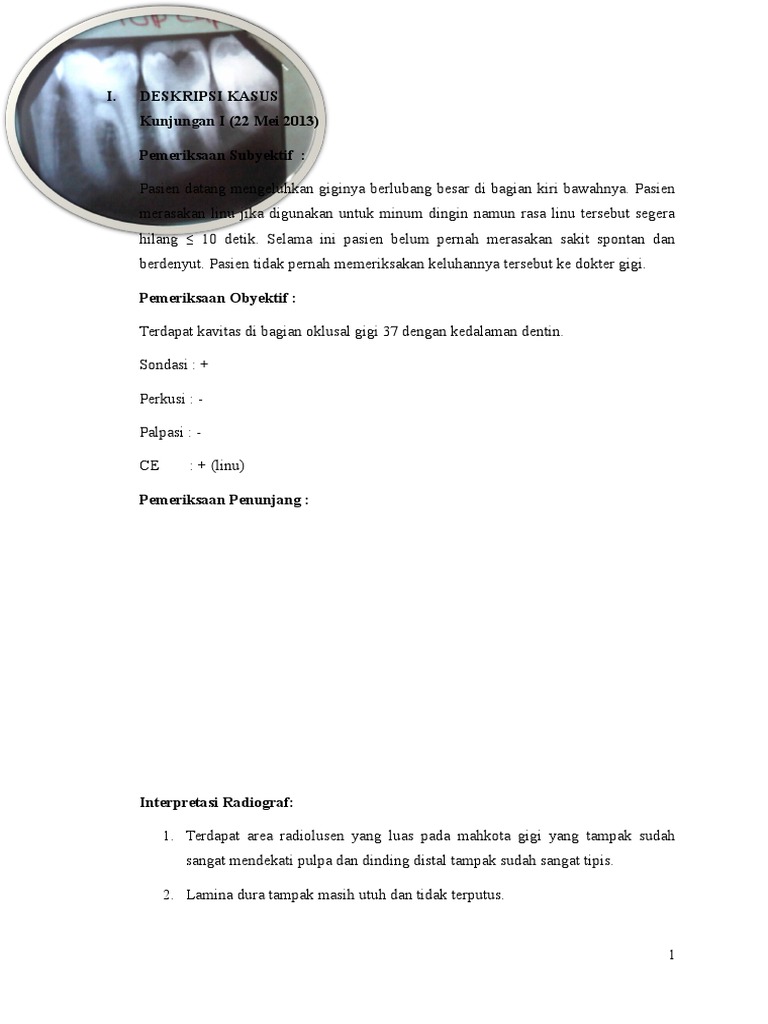 Resus Pulp Capping | PDF