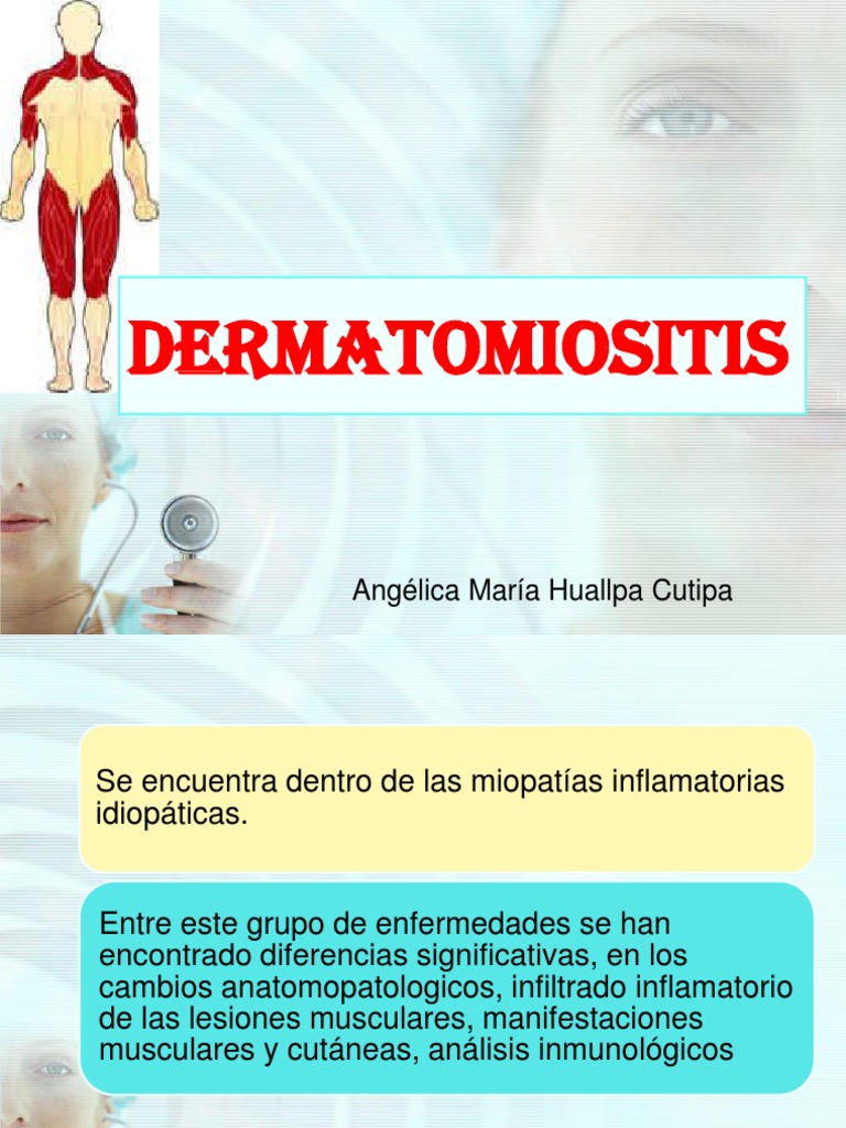 Dermatomiositis Final | Sistema inmune | Inflamación