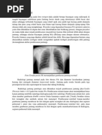 PDF Anatomi Thorax Normal Gambaran Radiologi Compress | PDF