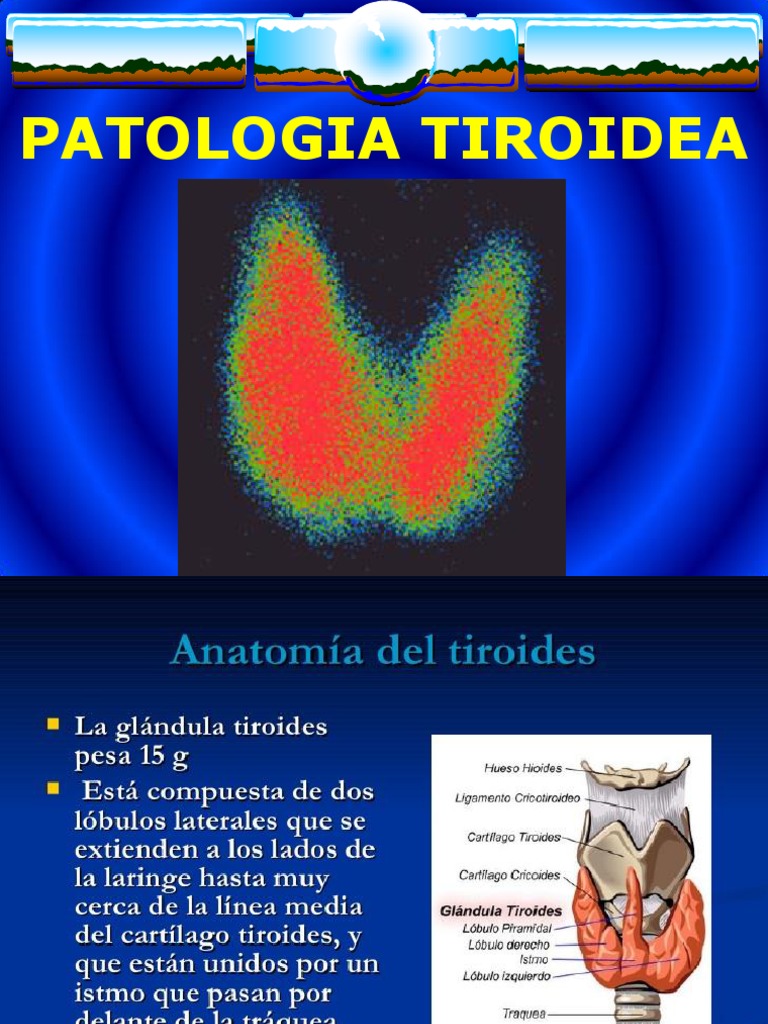 Patología Tiroidea | PDF | Tiroides | Hipertiroidismo