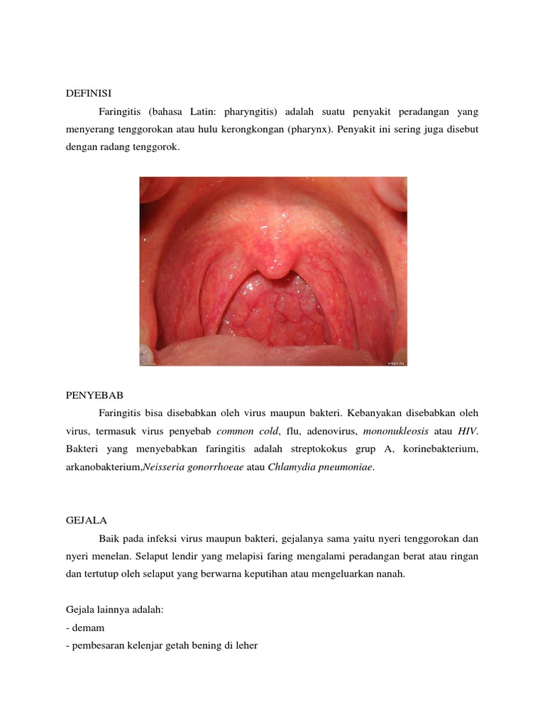 Faringitis | PDF | Sains & Matematika