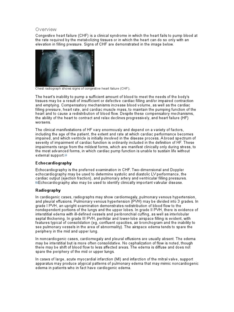 Chest Radiograph Shows Signs of Congestive Heart Failure (CHF ...