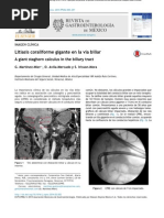 Anatomía del triángulo de Calot y Buddé | PDF | Vesícula biliar | Hígado