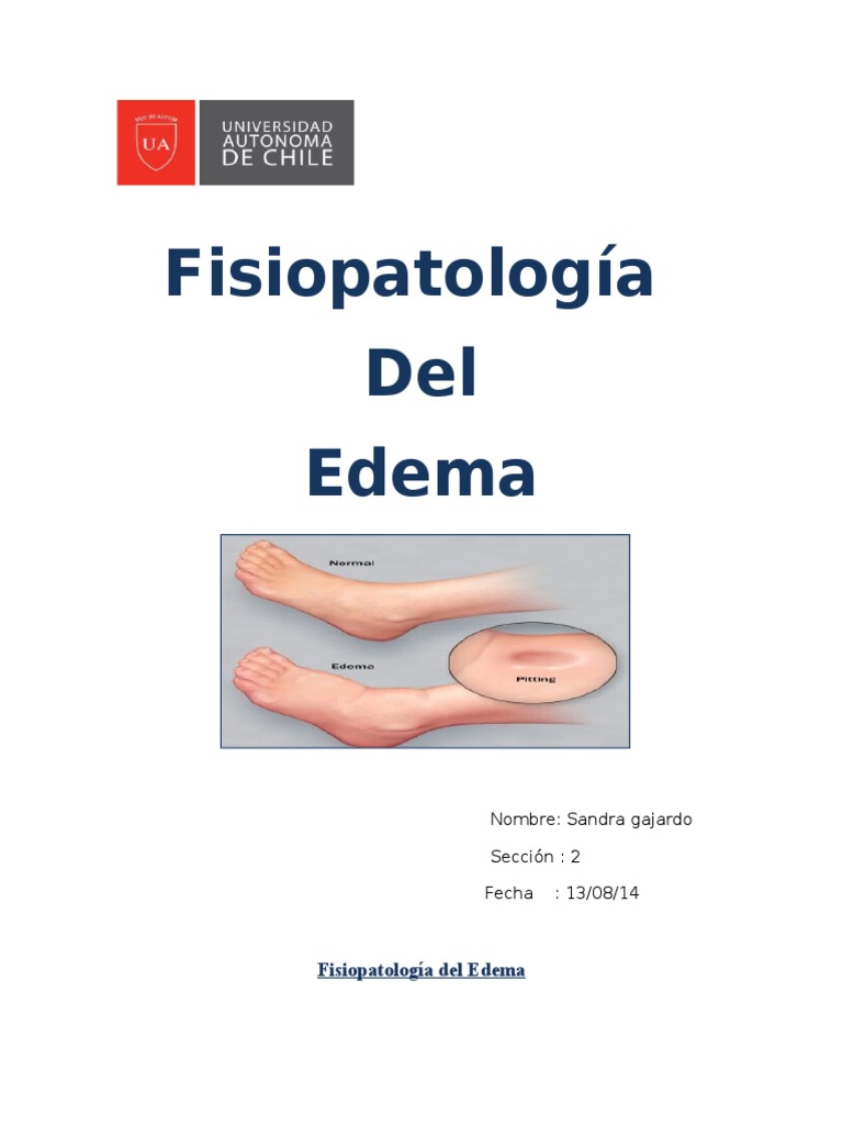 Fisiopatología - Doc EDEMA | PDF | Edema | Angiotensina