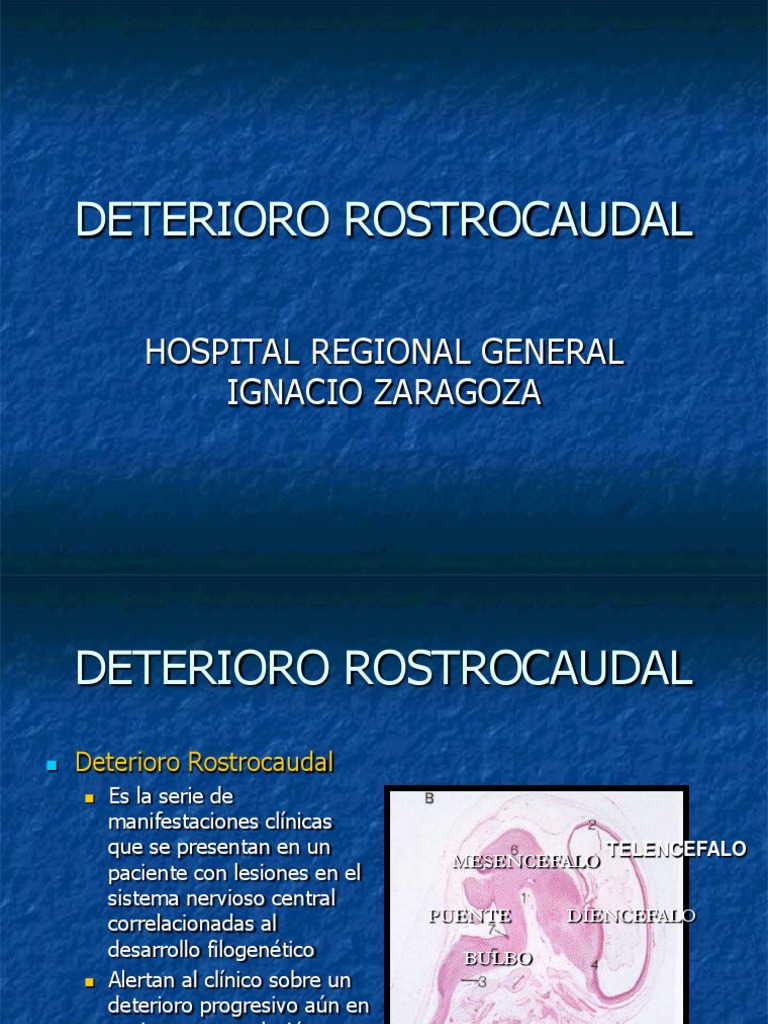 Deterioro Rostrocaudal: Signos y Síndromes | PDF | Coma | Cerebro