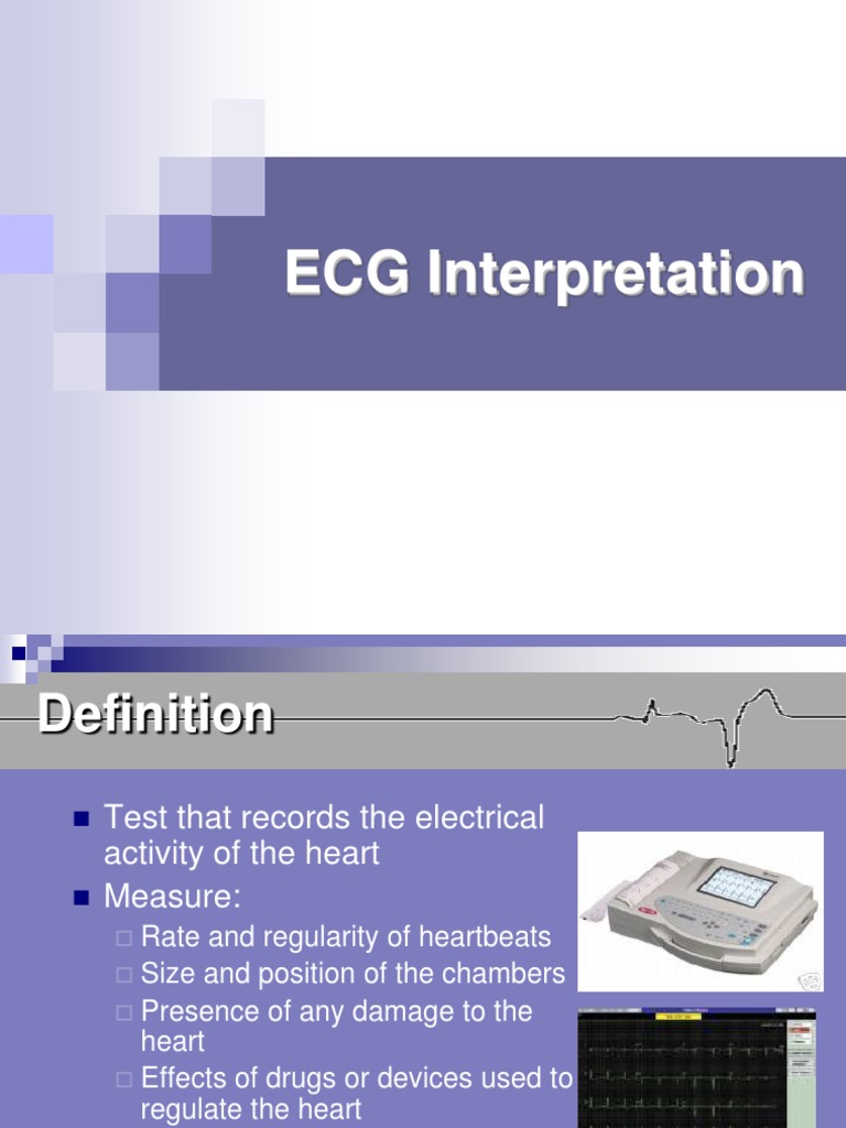 Ecg Presentation 2013 | PDF | Electrocardiography | Cardiac Arrhythmia