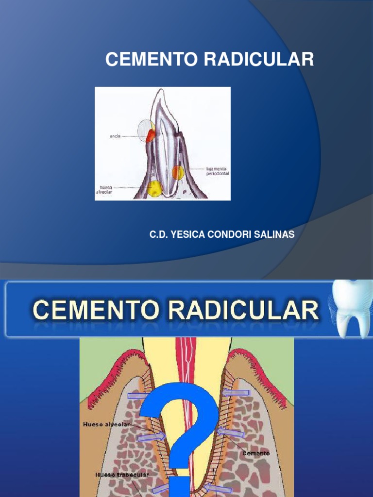 Tipos y características del cemento radicular | PDF | Hueso | Anatomía