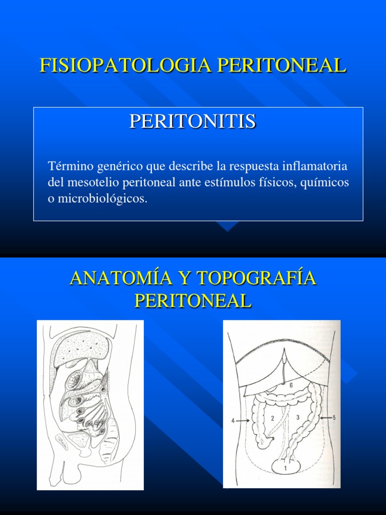 Peritonitis | PDF | Sistema digestivo | Enfermedades y trastornos