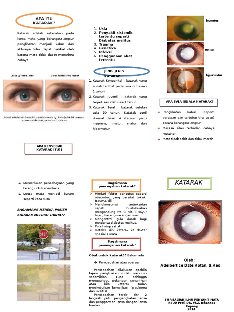 Leaflet Katarak