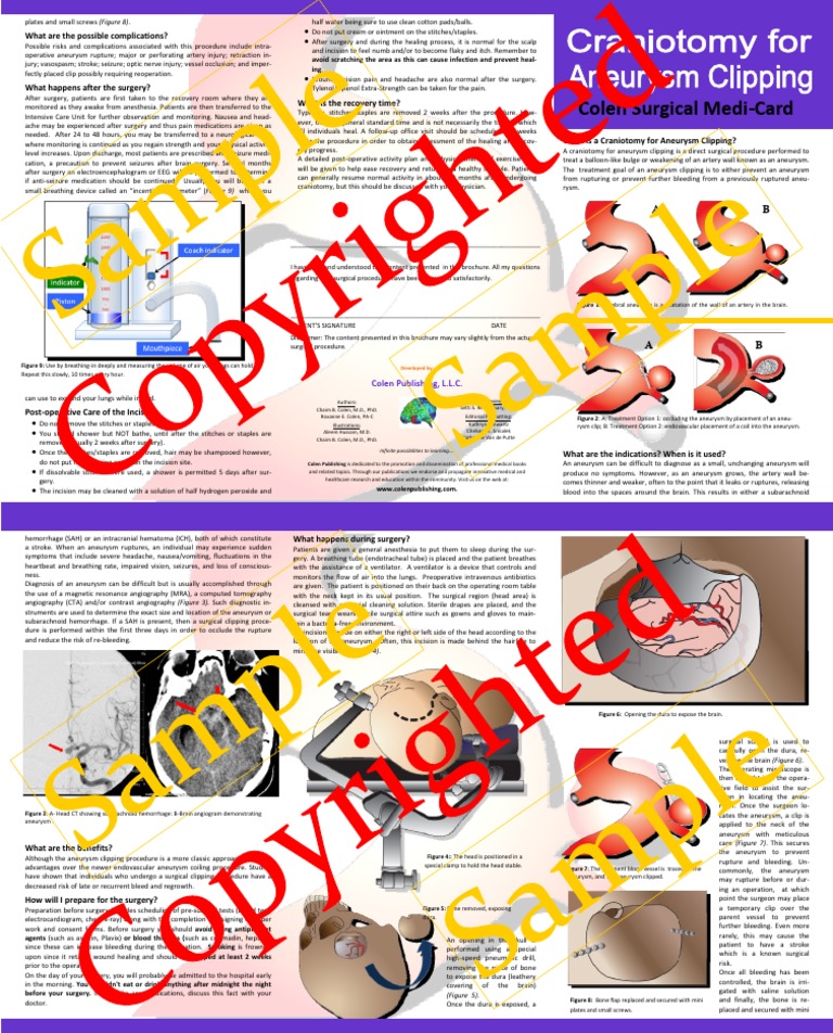 Craniotomy for Aneurysm Clipping Surgical Medi-Card | Neurosurgery ...