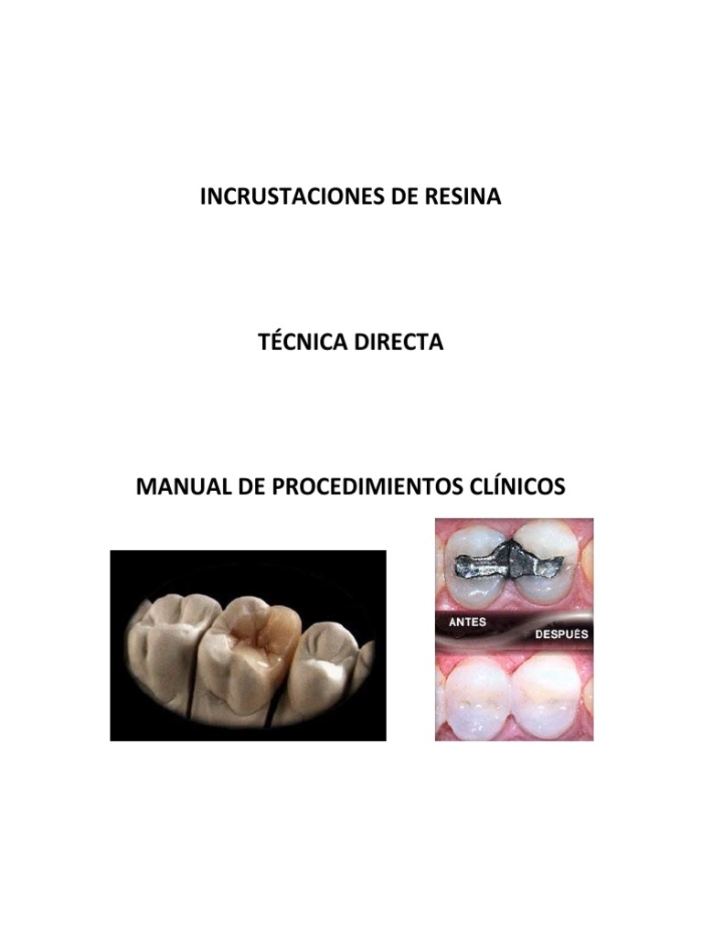 Protesis Fija Adhesiva | Descargar gratis PDF | Diente humano ... Protesis Fija Adhesiva | Descargar gratis PDF | Diente humano ...
