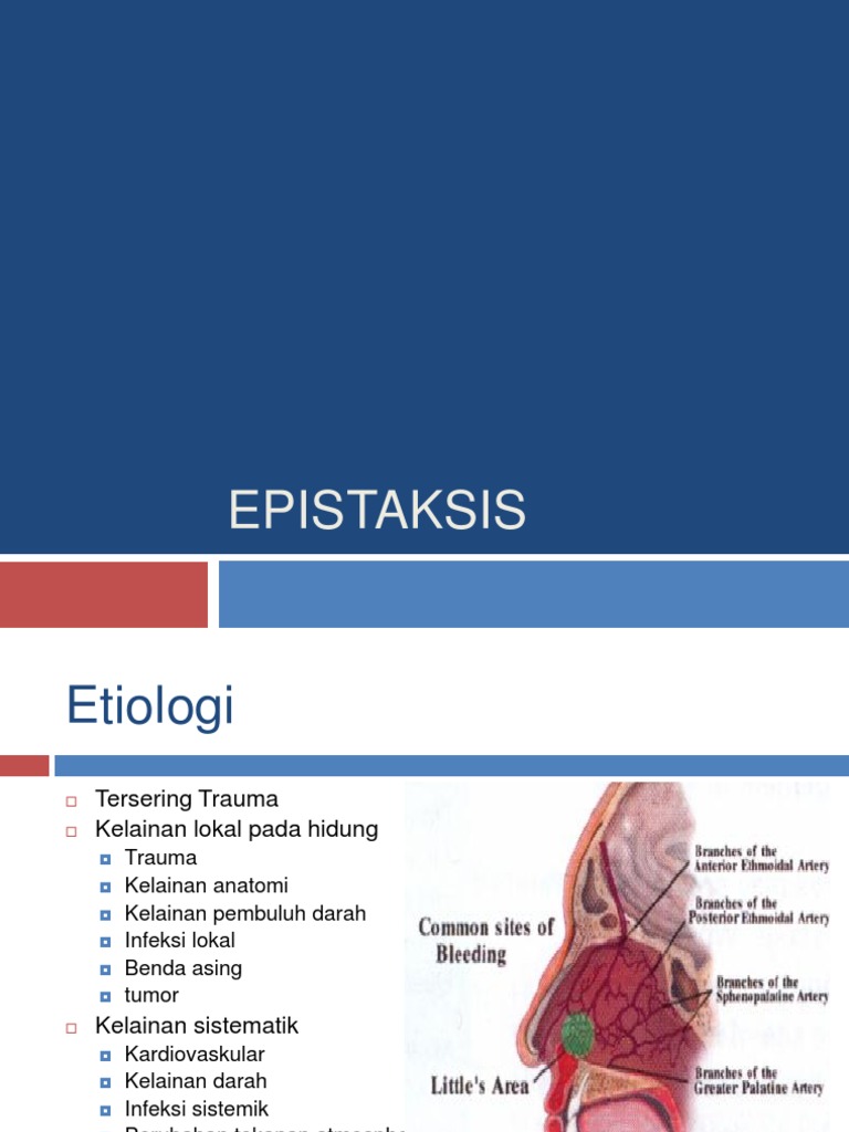 Epistaksis | PDF