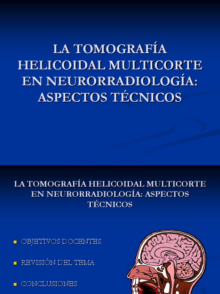 TAC Helicoidal Multicorte | PDF | Ct Scan | Rayo X