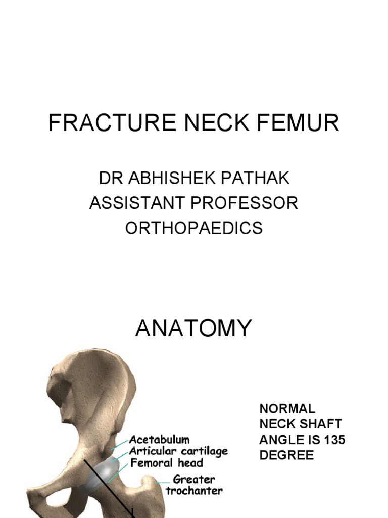 Femoral Neck Fracture Overview | PDF | Hip | Human Anatomy