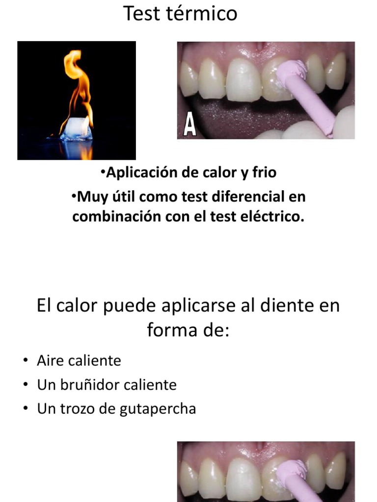 Test Térmico - Examen Rutinario en Odontologia | PDF