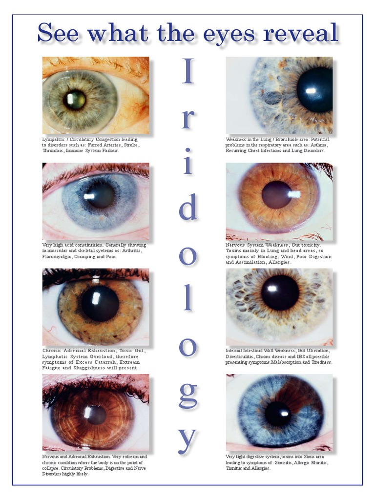 Iridology Samples