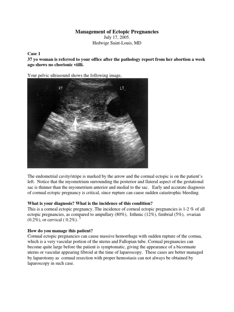Management of Ectopic Pregnancies | PDF | Human Reproduction | Medical ...