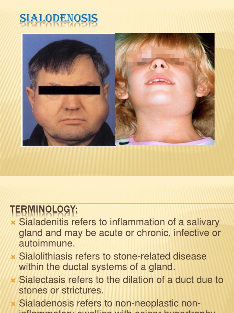 Sialodenosis | PDF | Medical Specialties | Medicine