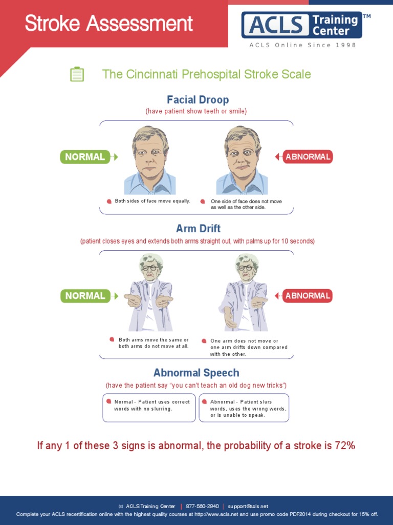 Algo Stroke | PDF | Stroke | Neurology
