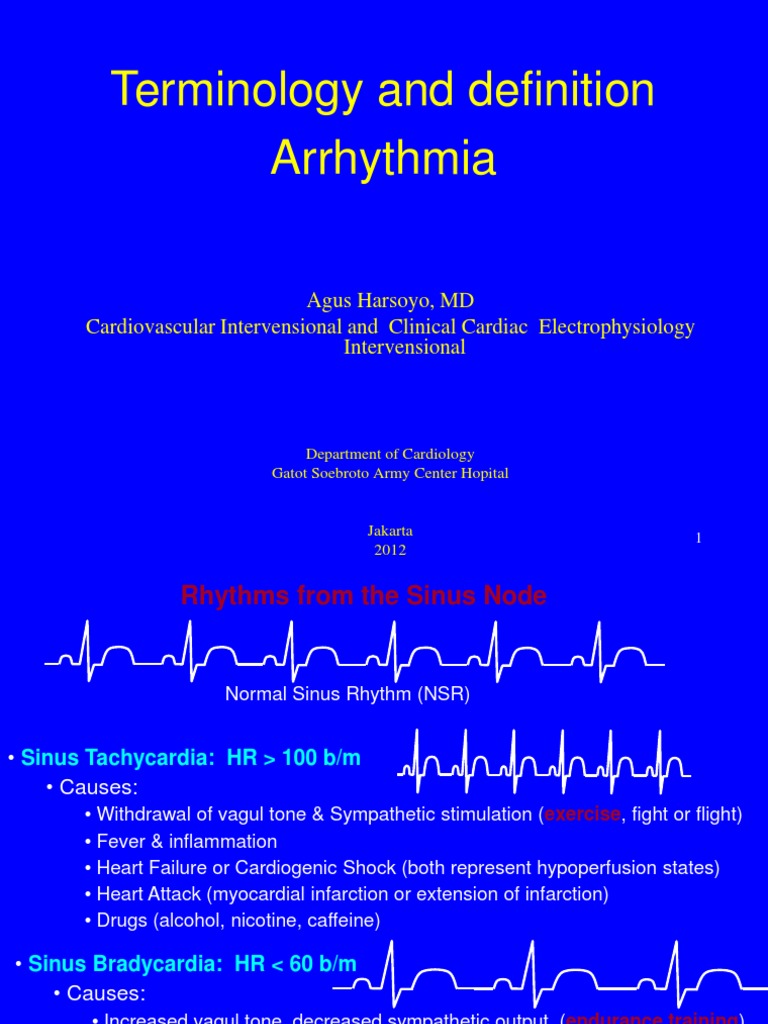 Arrhythmias.ppt | Cardiac Arrhythmia | Heart