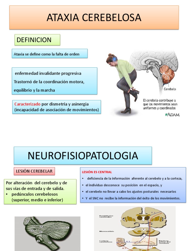 Ataxia Cerebelosa