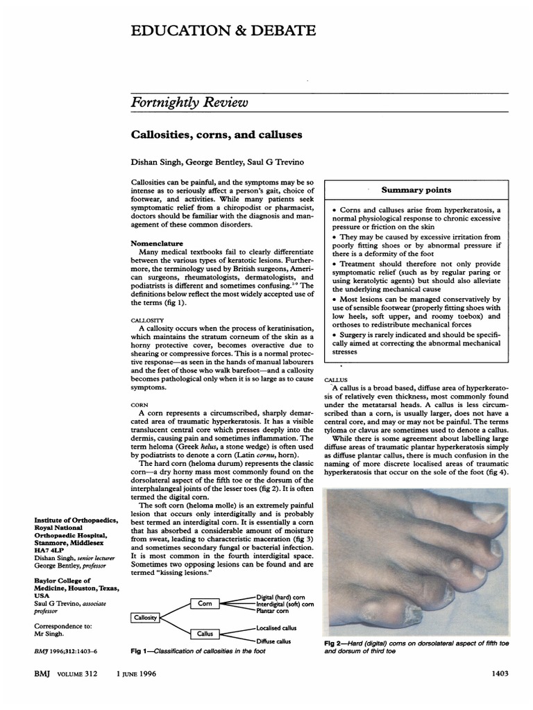 Clavus | PDF | Toe | Foot