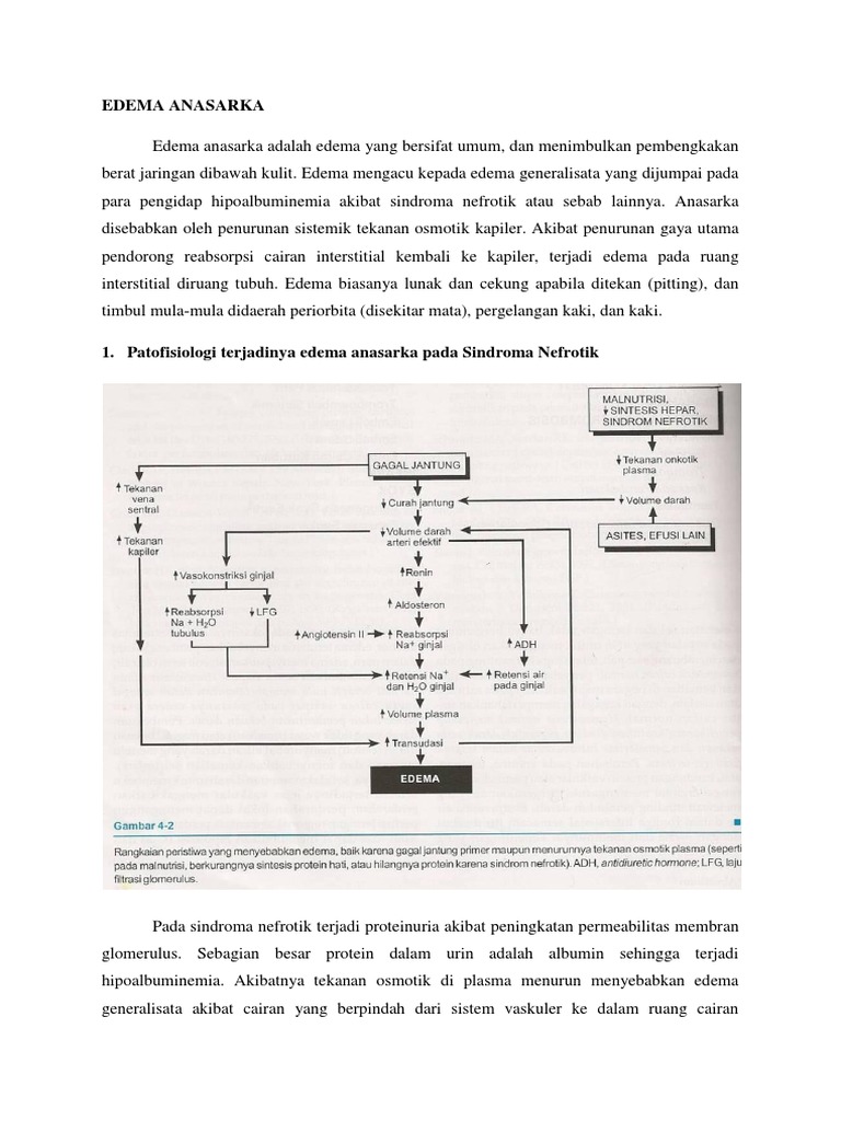 Edema Anasarka | PDF