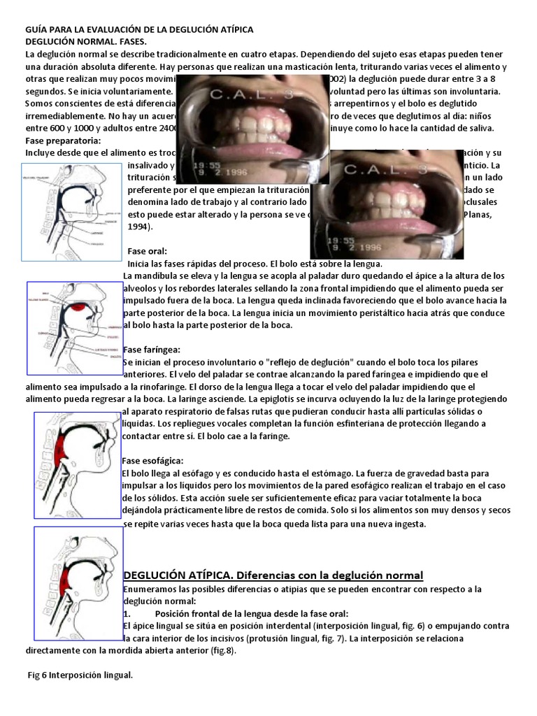 Guía para La Evaluación de La Deglución Atípica | PDF | Anatomía humana ...