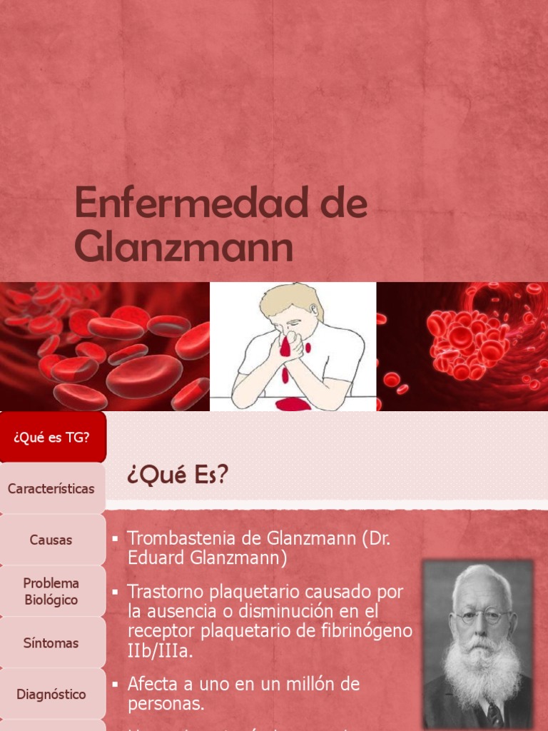 Trombastenia de Glanzmann: Diagnóstico y Tratamiento | PDF ...