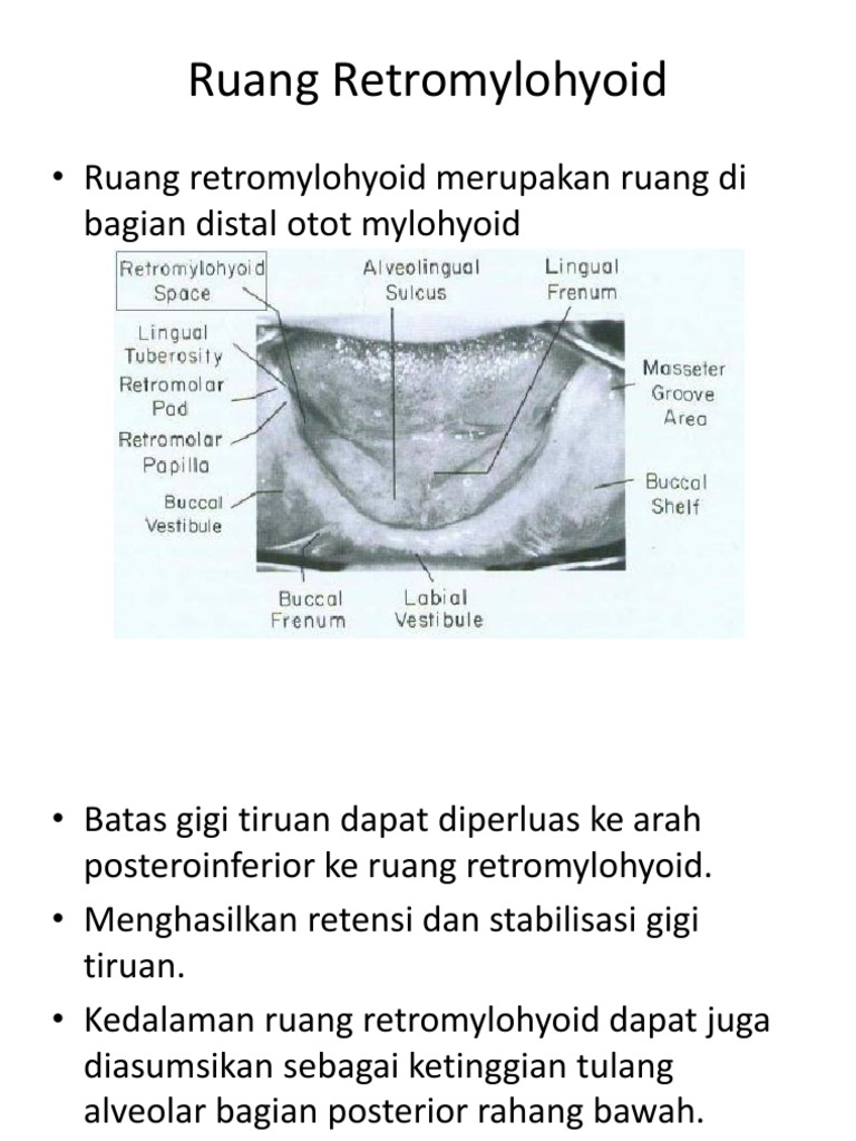 Retromylohyoid Space