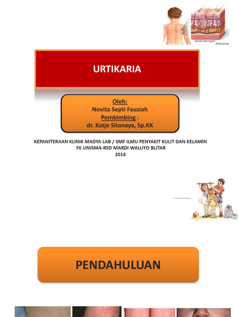 Referat Urtikaria | PDF