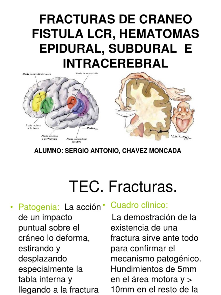 Fracturas de Craneo | Cráneo | Herida