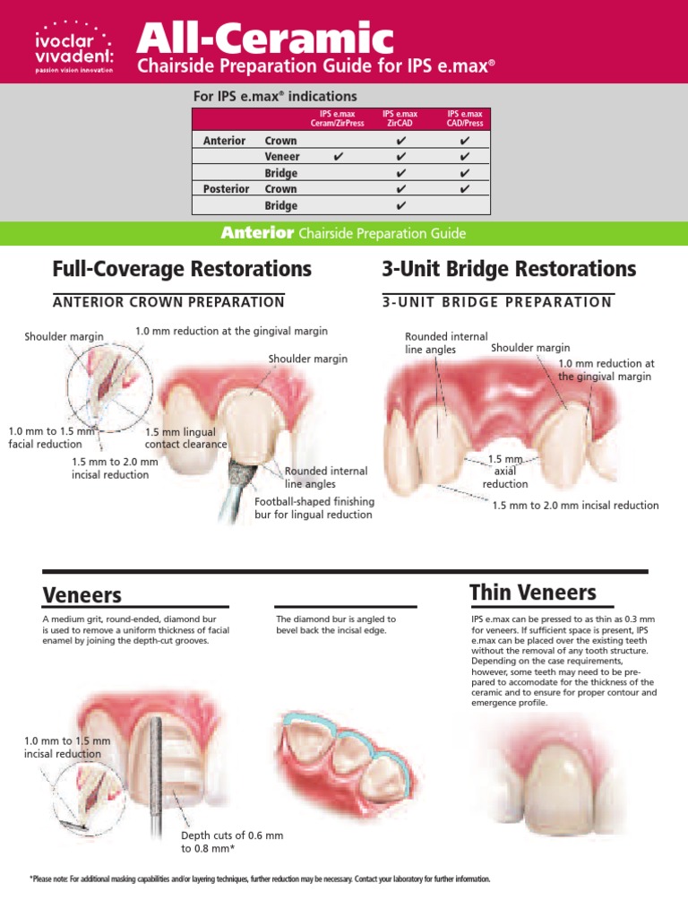 E.max Prep Guide | PDF | Dentistry | Dentistry Branches
