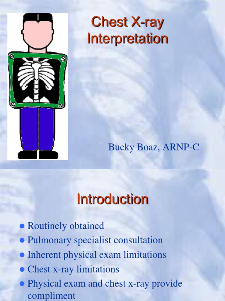 Chest X-Ray Interpretation: Bucky Boaz, ARNP-C | PDF | Lung | Thorax