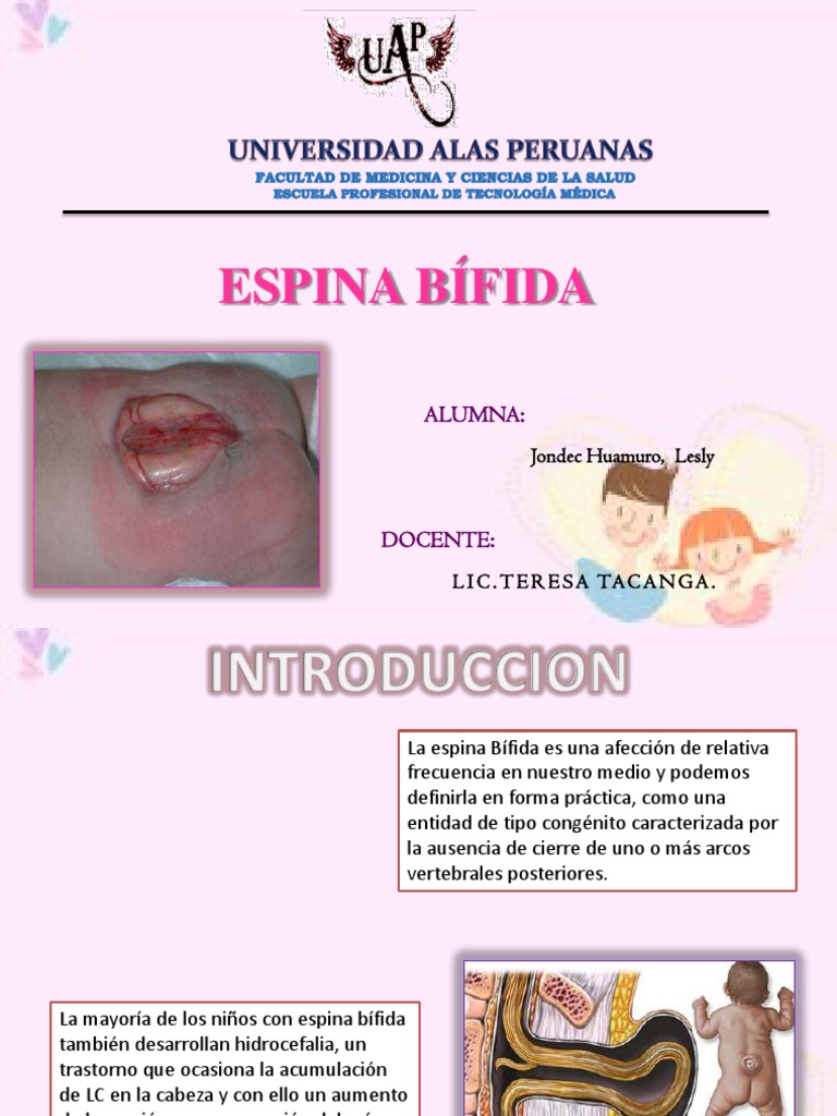espina Bifida | Especialidades Medicas | Medicina CLINICA
