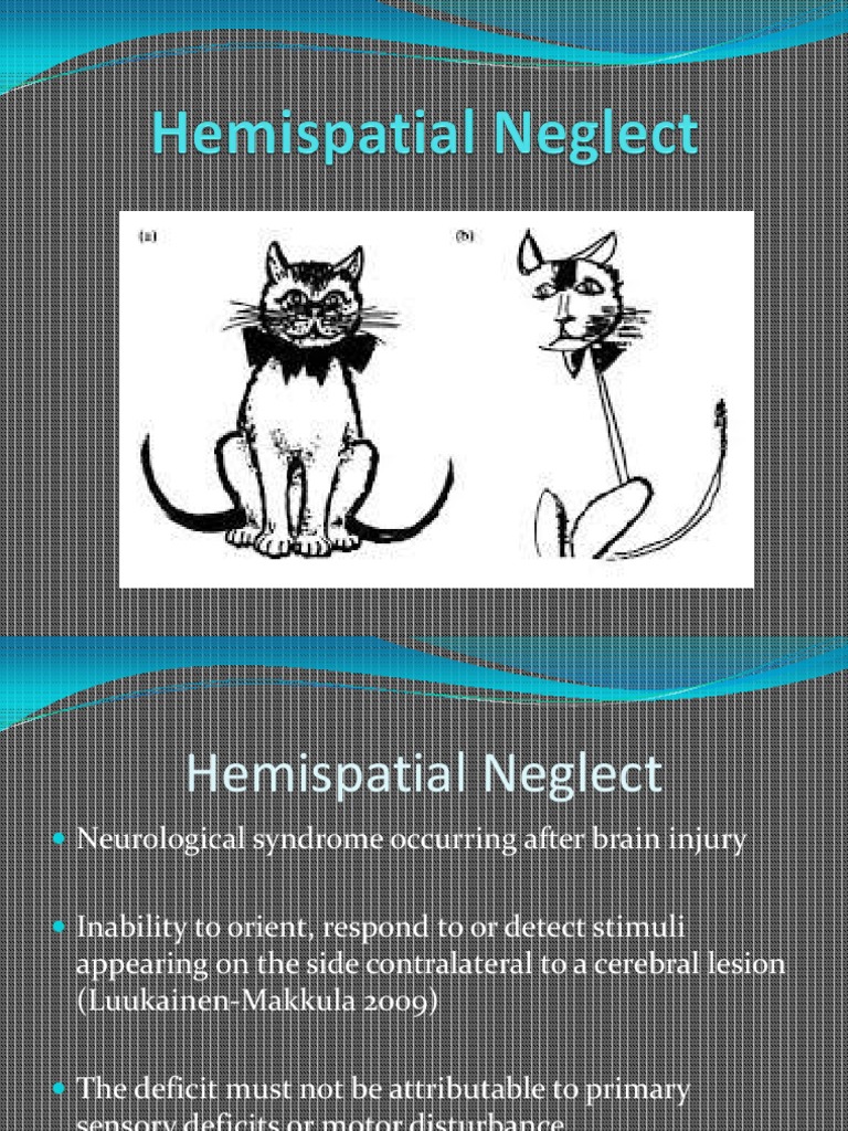 Hemispatial Neglect LDH | Attention | Mental Processes
