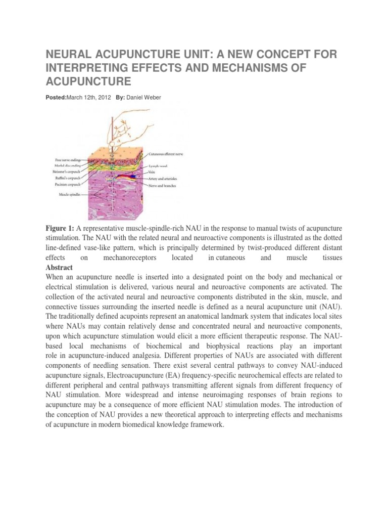 Neural Acupuncture Unit | PDF | Acupuncture | Placebo