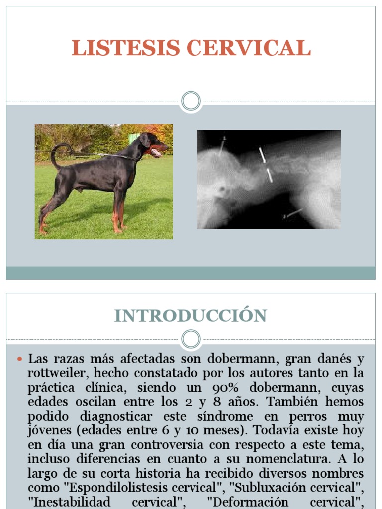 Listesis Cervical | PDF | Médula espinal | Medicina CLINICA