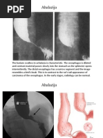 Bubbleshe Assessment: BREASTS 1. Palpate Both Breasts For | PDF ...