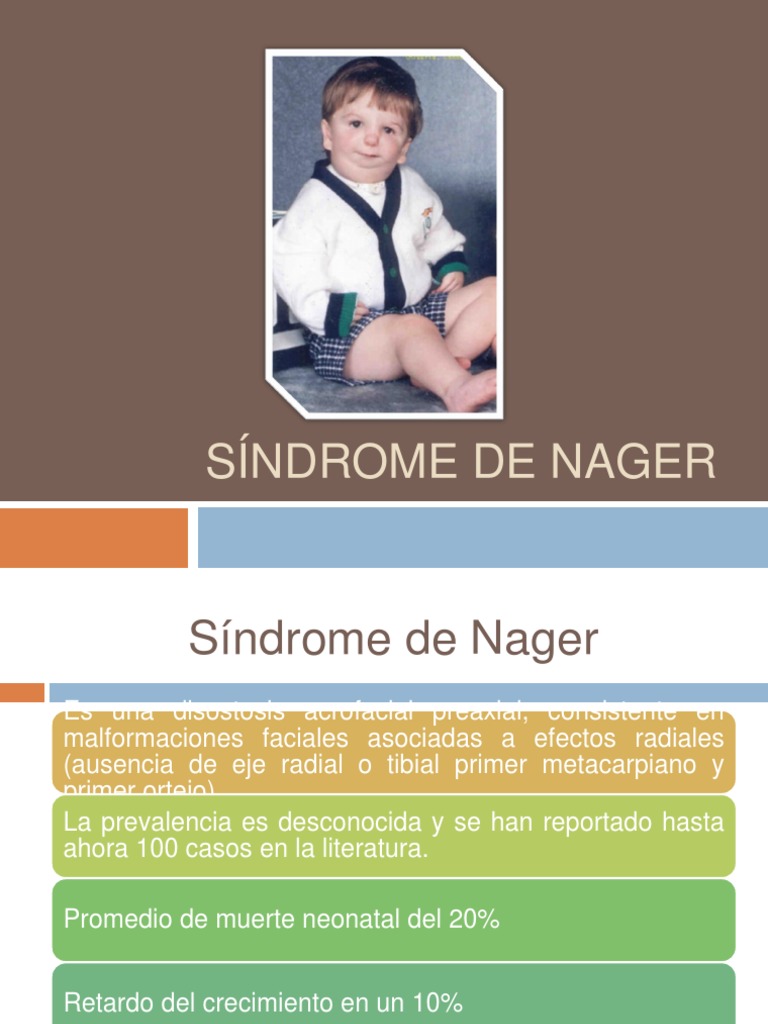 Síndrome de Nager | PDF | Infantes | El embarazo